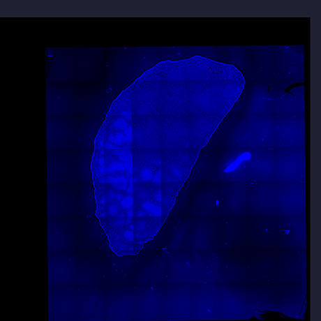 时空蛋白转录组Stereo-CITE - 华大时空