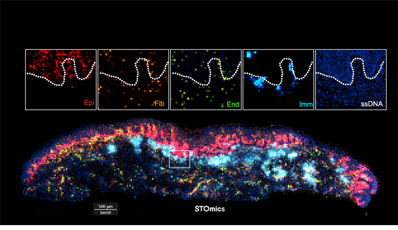 Sci China Life Sci | Stereo-seq助力揭示牙周炎的免疫异常机制 - 华大时空