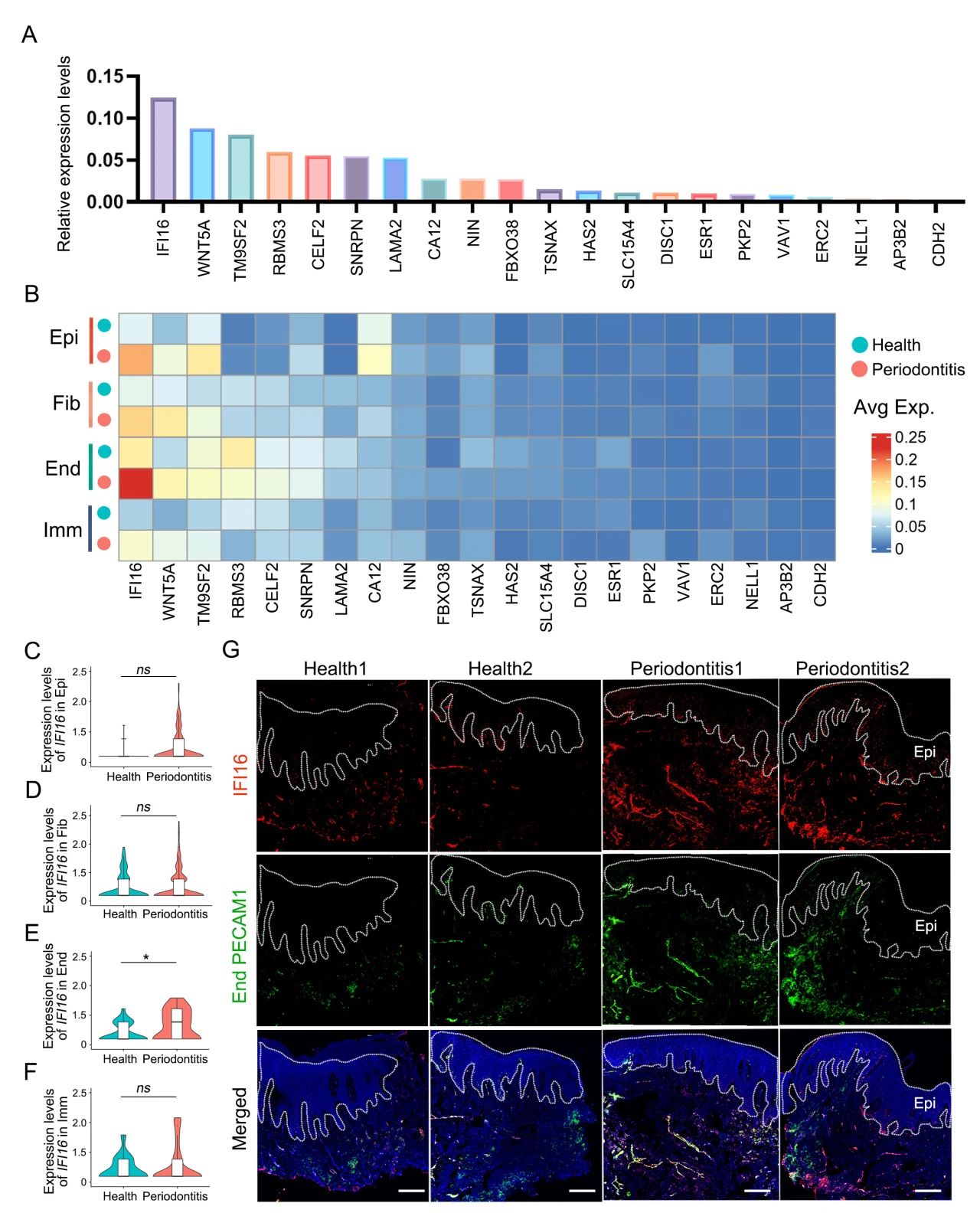 Sci China Life Sci | Stereo-seq助力揭示牙周炎的免疫异常机制 - 华大时空